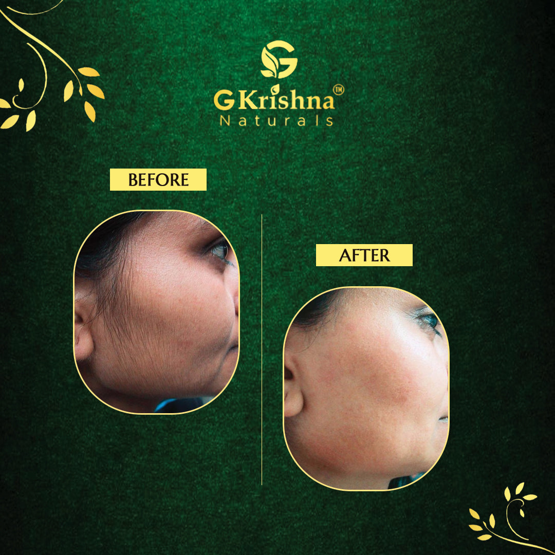 Facial Hair Prevention Powder – GK Naturals