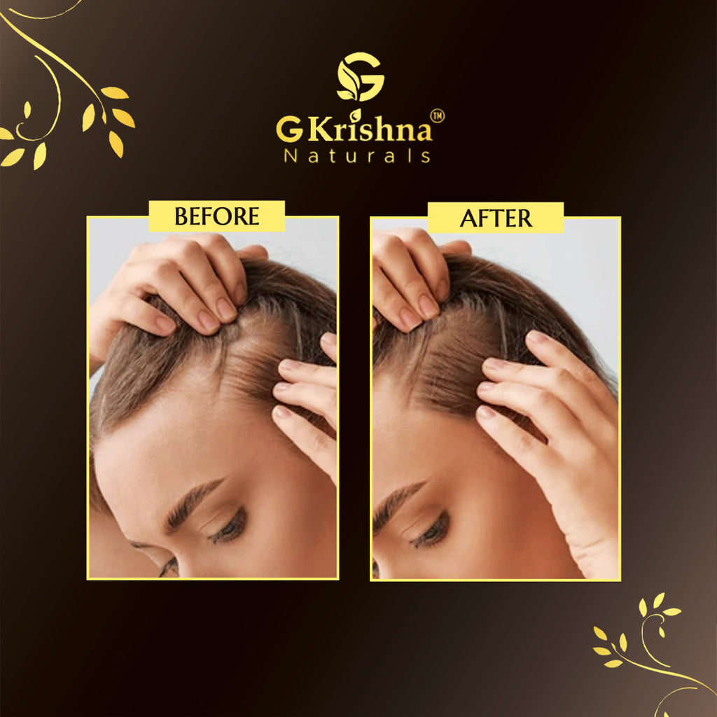 Keratin Detangle Shampoo – GK Naturals